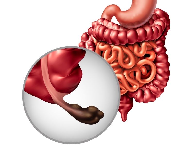 Prof. Dr. Özgür Fırat - İzmir Genel Cerrahi Uzmanı